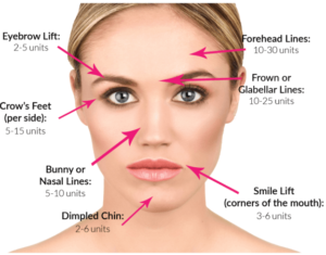 Eyebrow lift Botox cost | Botox treatment | Womanishs